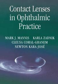 Contact Lenses in Ophthalmic Practice - Pocket/Paperback (9780387404004 ...